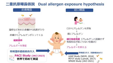 国立成育医療研究センターアレルギーセンター【公式】 On Twitter 乳児期の アトピー性皮膚炎 への早期治療介入が 鶏卵