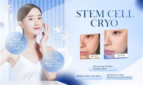 Stem Cell Cryo Liệu Trình Chăm Sóc Cấp ẩm Tái Tạo Da Aura Clinic