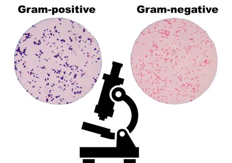 Bacillus Gram Stain Positive