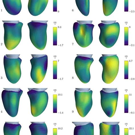 Velocity Outlet Boundary Condition For The Simulation Cohort Resulting
