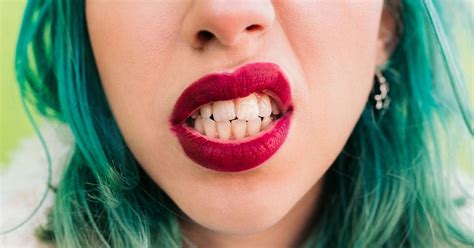 Cold Sore Stages Pictures Identify Treat Early Symptoms