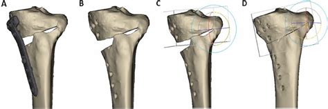Steps To Create A Three Dimensional 3d Model Of A Pre Osteotomy