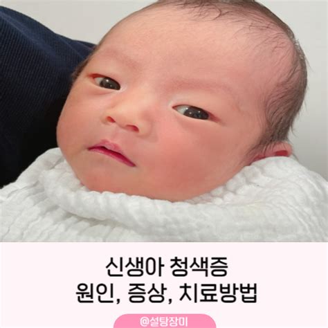 신생아 청색증의 대한 모든 것 원인 증상 치료방법에 대해 알아봐요