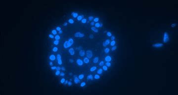 High Resolution Transcriptome Analysis With Long Read RNA Sequencing RNA Seq Blog