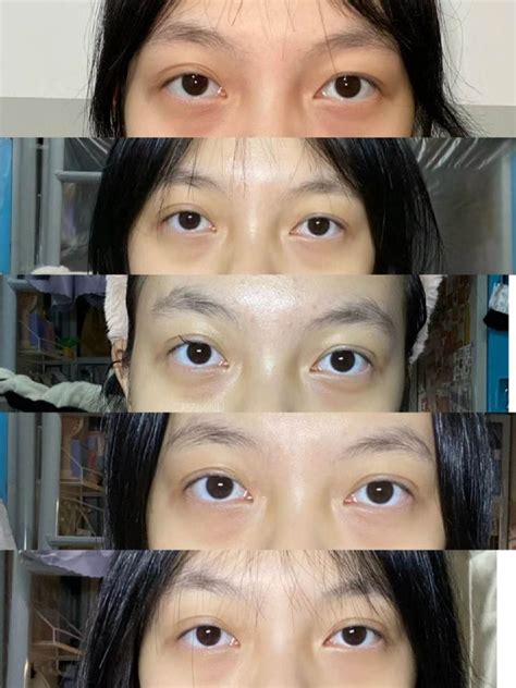 别太牛了！为什么【协和皮肤科医生】推荐的眼霜去黑眼圈和细纹那么厉害？细纹没了，黑眼圈淡了！ 知乎