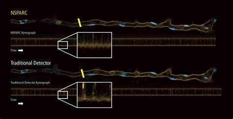 Ax Ax R With Nsparc Ax Ax R With Nsparc Confocal And