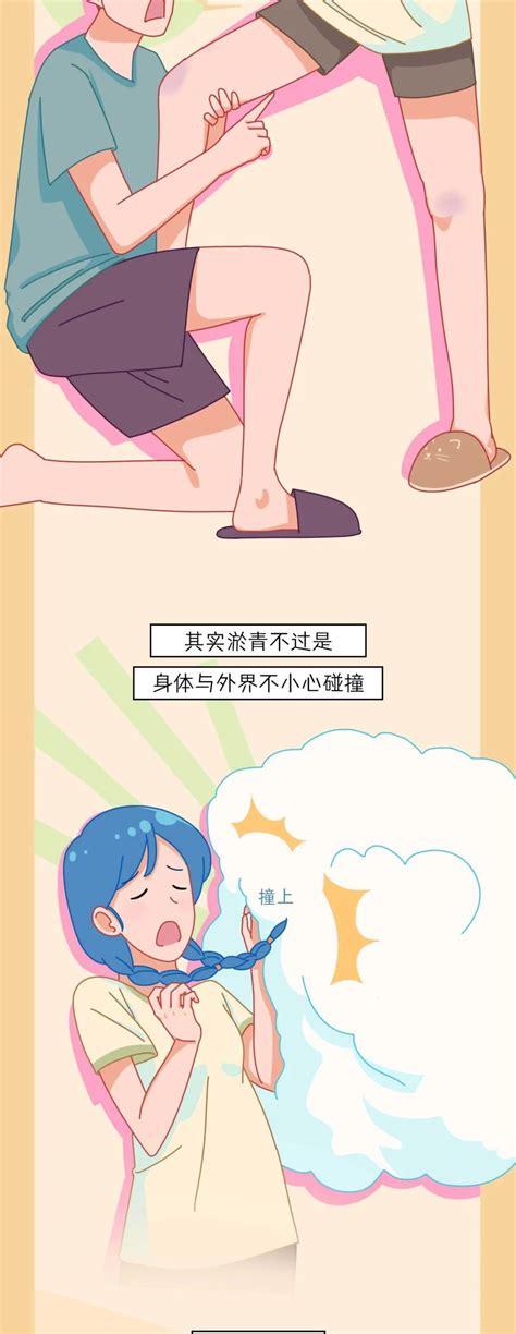 女生身上為啥總是會出現「淤青」？（漫畫） 頭條匯