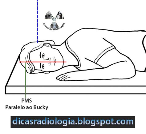 Dicas De Radiologia Posicionamento De Raio X De CrÂnio Em Perfil