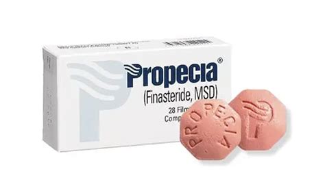 Luso Della Finasteride Nellalopecia Androgenetica