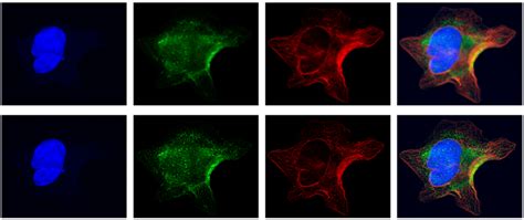 Digital Confocal Option 2d Real Time Deconvolution Widefield Microscopy