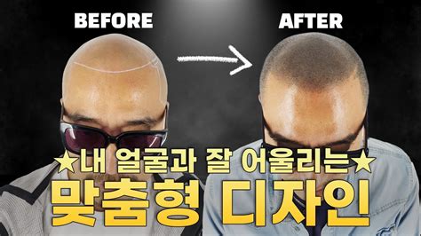 내 얼굴에 맞는 맞춤형 두피문신 디자인 Youtube