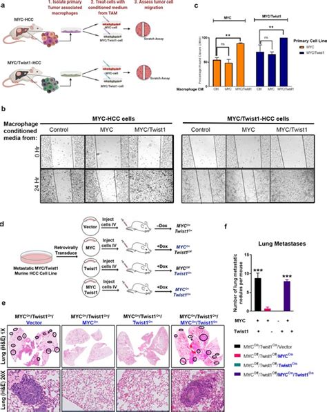 Myc And Twist1 Cooperate To Drive Metastasis By Eliciting Crosstalk Between Cancer And Innate