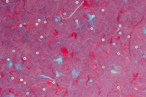 Staphylococcus Aureus