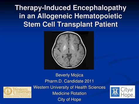 Ppt Therapy Induced Encephalopathy In An Allogeneic Hematopoietic