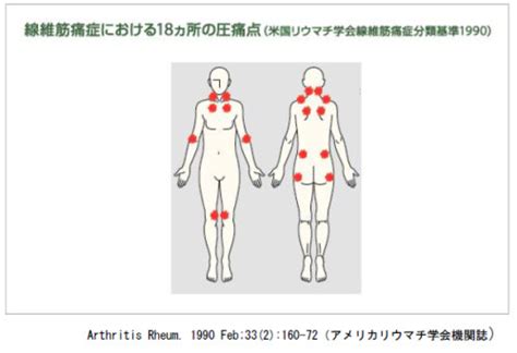線維筋痛症（fibromyalgia：fm）の鎮活 がん三次予防の先進的予防