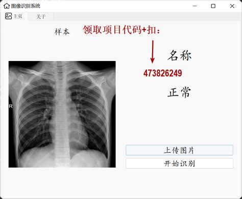 基于tensorflow搭建卷积神经网络cnn（新冠肺炎医学图像识别）保姆及级教程tensorflow框架下cnn图像的预测 Csdn博客