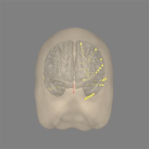 Working With Seeg Data — Mne 122 Documentation