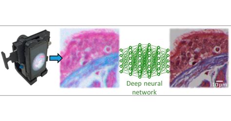 Deep Learning Enhanced Mobile Phone Microscopy Acs Photonics