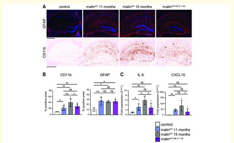 Inflammatory Response After Malin Restoration At Advanced Stage Of