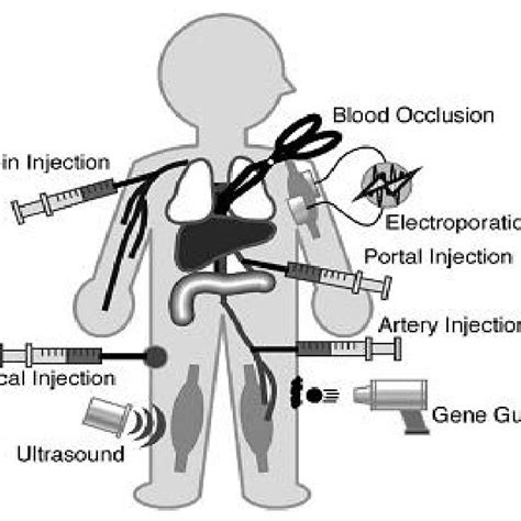 Different Injection Routes Of Naked DNA And Enhancement Strategies