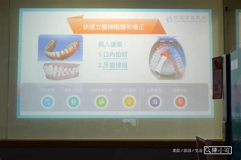 台北士林牙醫診所全瓷冠 瓷牙貼片悅庭牙醫診所做假牙只要兩小時就可完成隱形矯正安全植牙診所 陳小可的吃喝玩樂