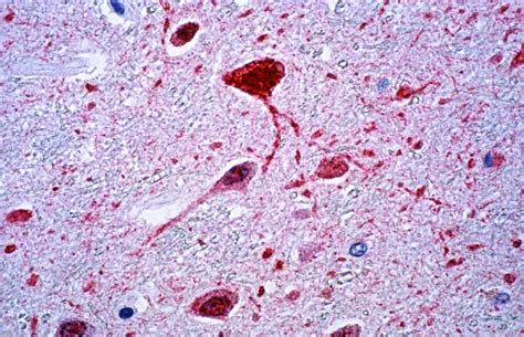 Free Picture Nipah Virus