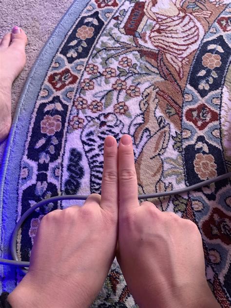 Does This Look Like Chilblains R Reynaudsdisease