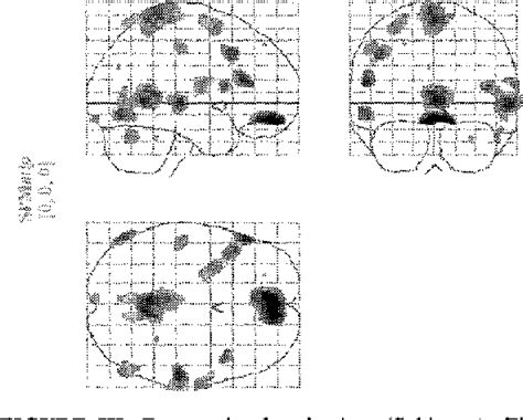 Figure 111 From Functional Mri Measurement For The Visual Target Stimulus In Oddball Paradigm