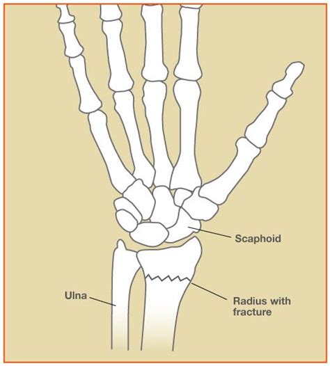 Scaphoid Fossa Wrist
