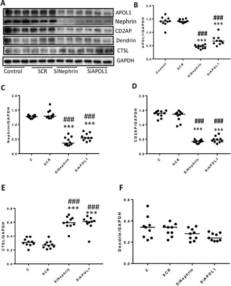 Apol1 Mir193a 轴的破坏会导致足细胞肌动蛋白细胞骨架的紊乱。 Scientific Reports X Mol