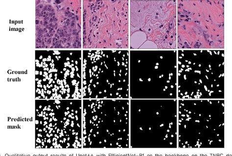 Figure 1 From Breast Tumor Cell Nuclei Segmentation In Histopathology Images Using