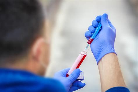 Teste Pode Facilitar O Tratamento Da Esclerose Múltipla