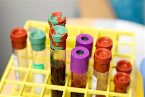 Protocol For Pbmc Isolation From Buffy Coat Samples