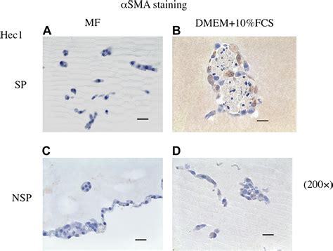 Stem Cells In Human Normal Endometrium And Endometrial Cancer Cells