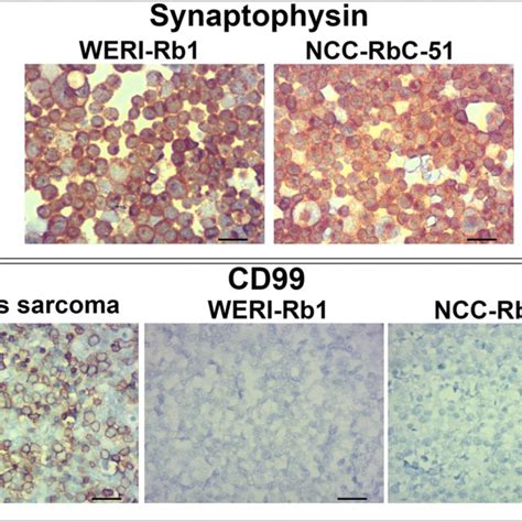 Photomicrographs Showing Positive Staining For Synaptophysin A In The Download Scientific