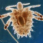 Difference Between Tag Archive For Lice Lice