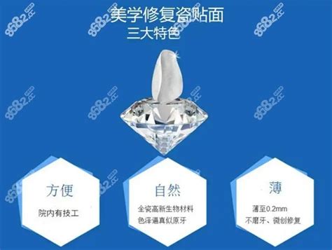 牙齿贴面材料有哪几种类型常用的牙贴片材质是树脂和全瓷牙齿美白 8682整形网