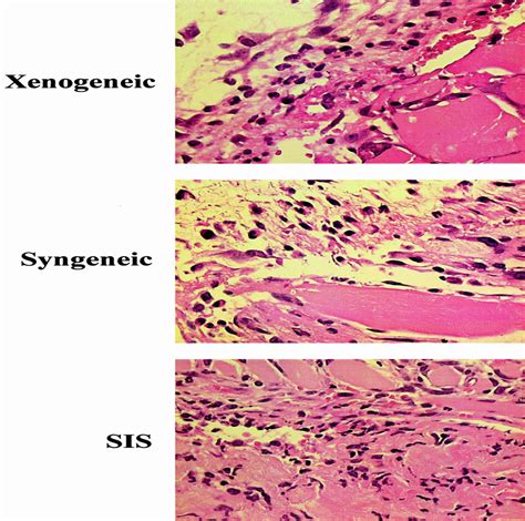 Xenogeneic Extracellular Matrix Grafts Elicit A Th2 Restrict