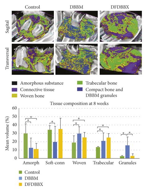 Micro Ct Scanning Of The Mandibular Defect And Volume Percentage Of