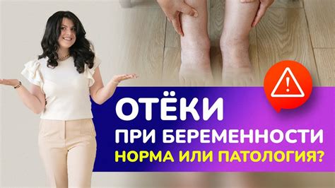 Народные мочегонные средства от отеках при беременности