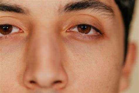 Your Face Can Show Signs Of Fatty Liver Disease