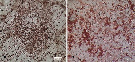The Effect Of Bifidobacterium Bifidum Supernatant And Cell Mass On The