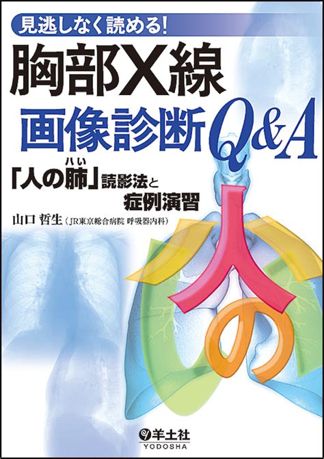 見逃しなく読める！ 胸部x線画像診断qanda〜「人の肺」読影法と症例演習 羊土社【2022】 演習 伝授 症例