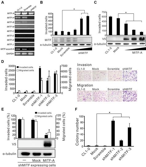 Mitf Promotes Cell Invasion And Migration In Lung Adenocarcinoma Cells
