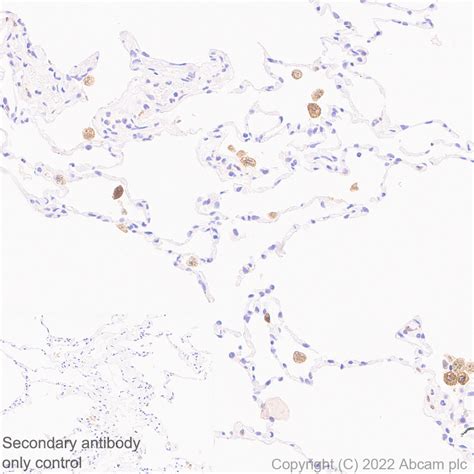 Anti Heme Oxygenase 1 Antibody 23heme Oxygenase 1 Ab302671 Abcam