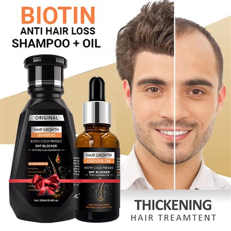 Hair Growth Essential Oil Biotin Cold Pressed Dht Blocker And Hair