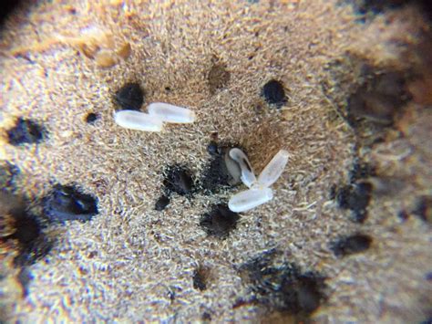 Lice Egg Shells Copy A Bushsnob In Africa