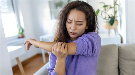 Pictures Of Flea Bites On Humans Plus Treatments Goodrx