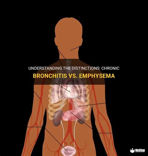 Understanding The Distinctions Chronic Bronchitis Vs Emphysema Medshun