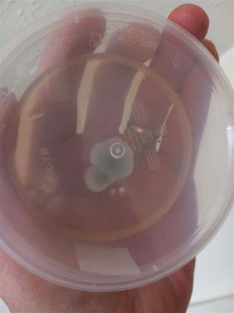 First Attempt Spore Print To Agar Mushroom Cultivation Shroomery